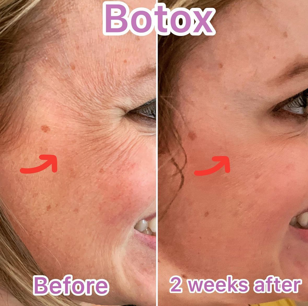 Medspa Gallery | Willis Cosmetic Surgery | Medspa St. Louis